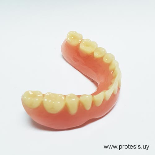 Prótesis dentales completas - Clínica de Prótesis e Implantes