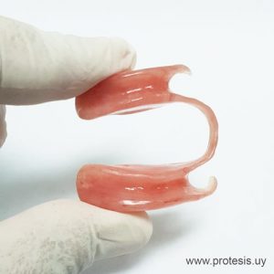 Prótesis dentales flexibles - Clínica de Prótesis e Implantes