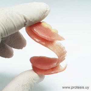 Prótesis dentales flexibles - Clínica de Prótesis e Implantes
