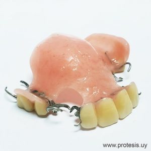 Prótesis dental parcial removible. - Clínica de Prótesis e Implantes